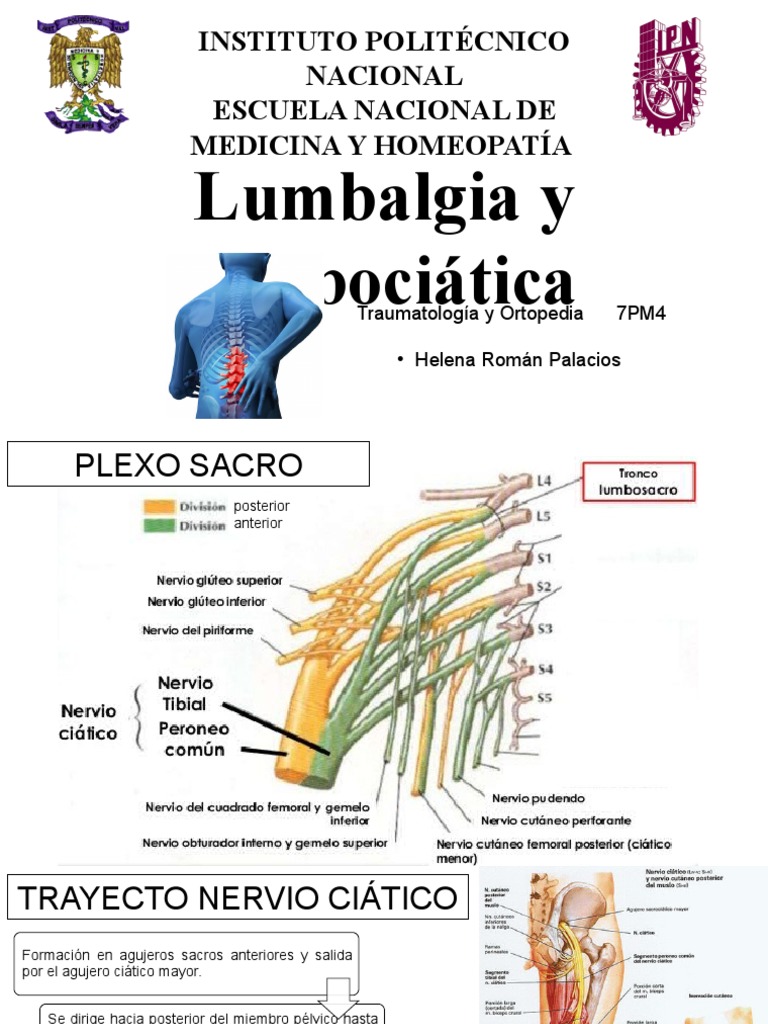 Lumbalgia y Lumbociática | Descargar gratis PDF | Dolor lumbar | Medicina