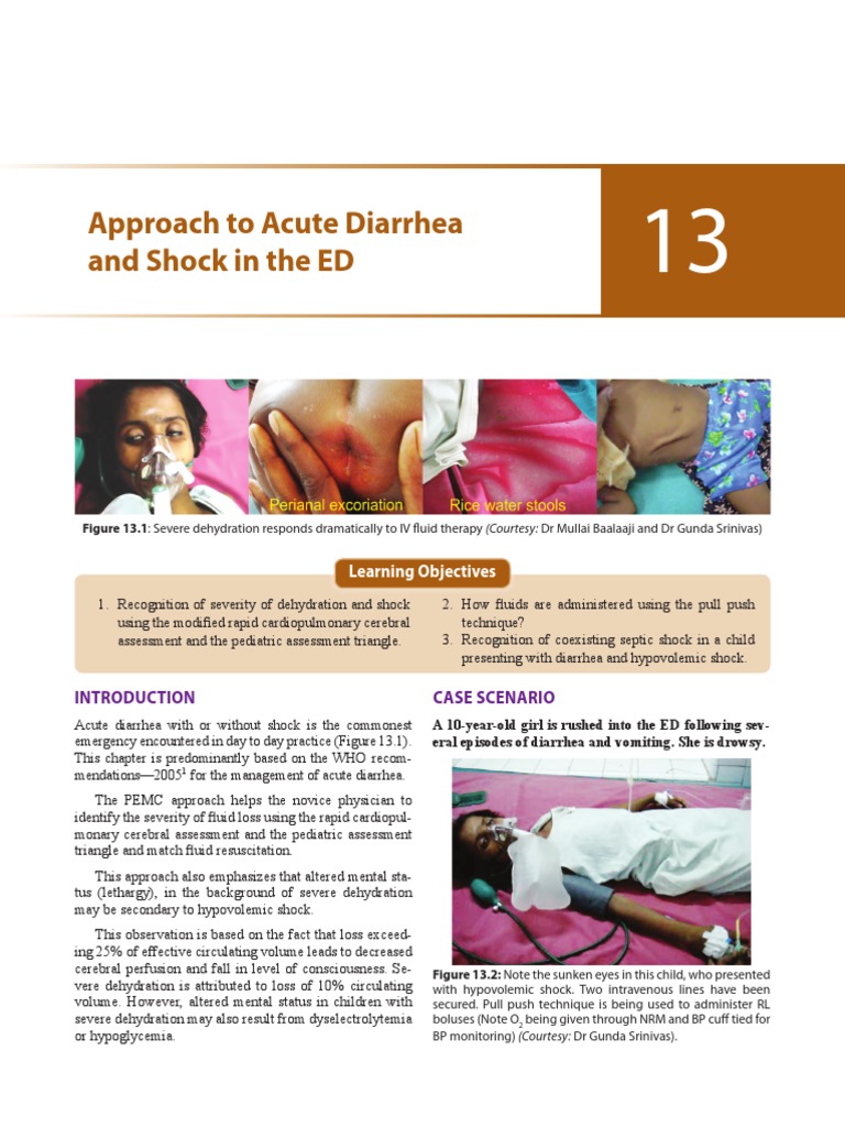 Managing Acute Diarrhea and Shock in Kids | PDF | Shock (Circulatory ...
