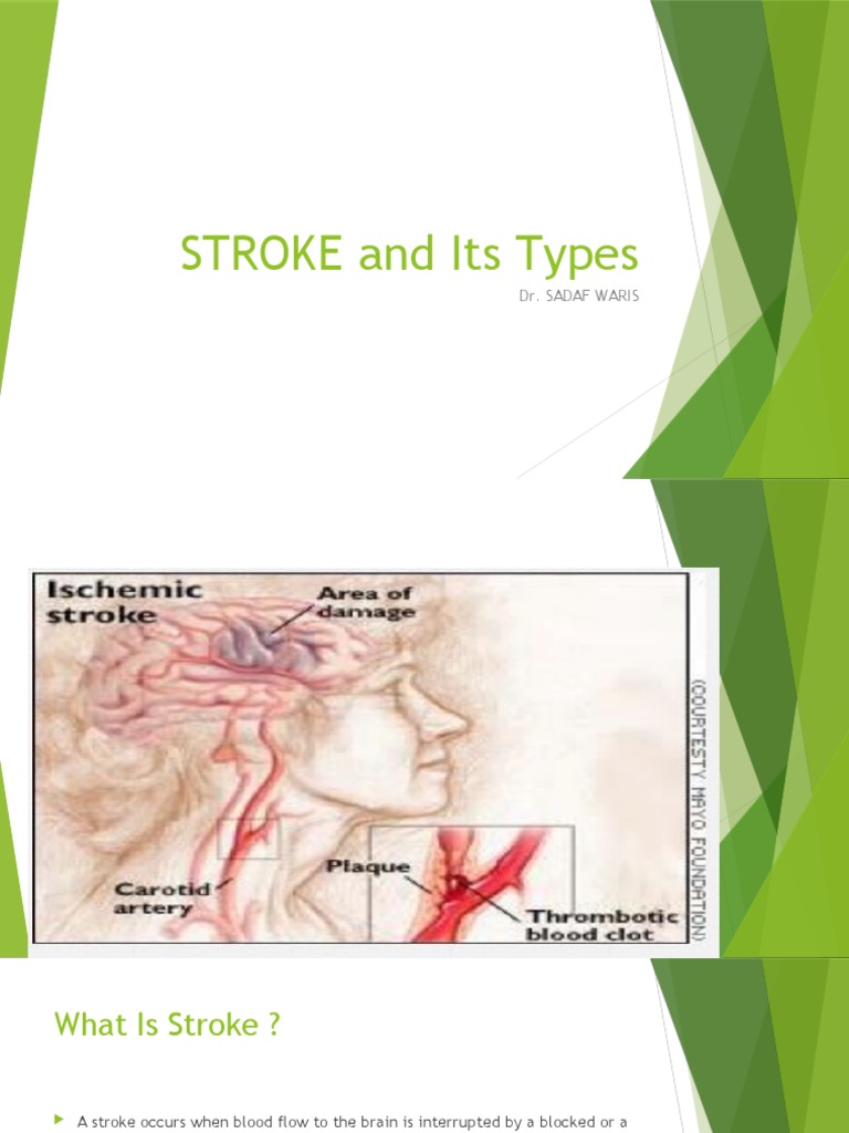 STROKE and Its Types | PDF | Stroke | Ischemia