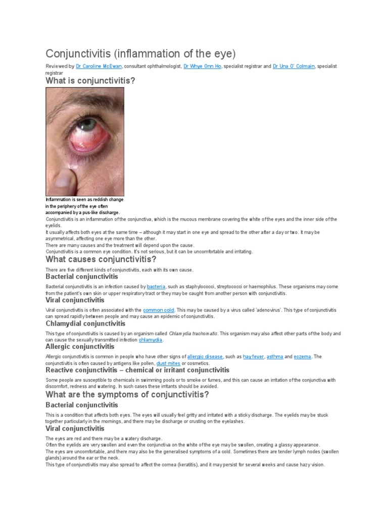 Conjunctivitis | PDF | Clinical Medicine | Immunology