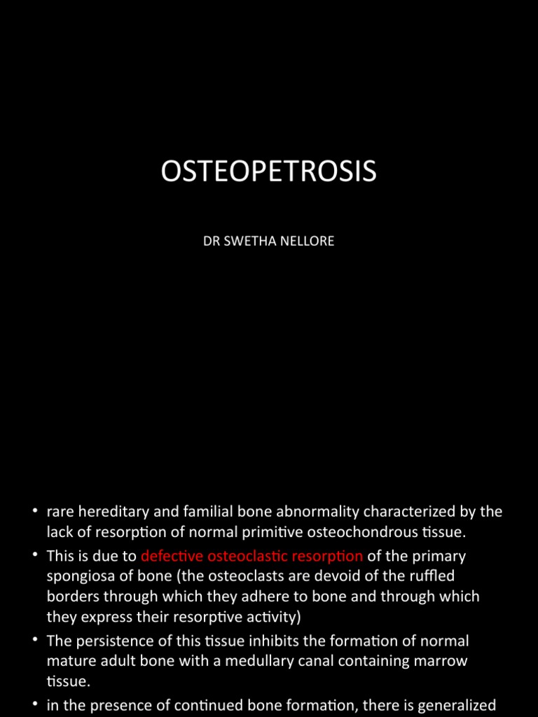 A Comprehensive Review of Osteopetrosis Covering its Etiology ...