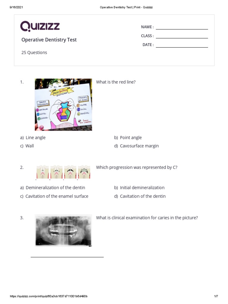 Operative Dentistry Practice Test: Questions Covering Cavity ...