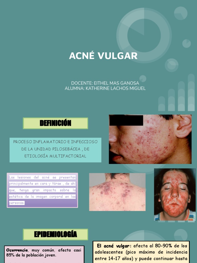 Acne Vulgar | PDF | Especialidades Medicas | Medicina CLINICA