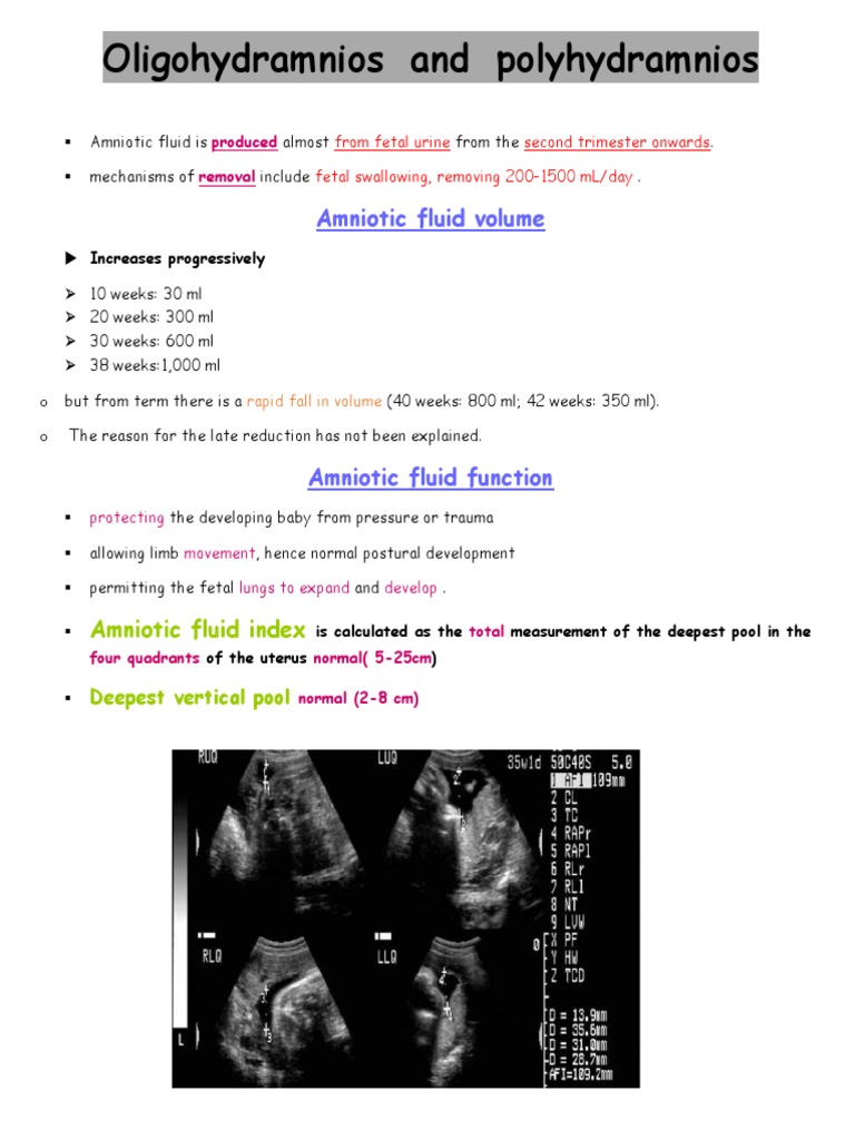 Oligohydramnios vs Polyhydramnios Overview | PDF | Fetus | Clinical ...