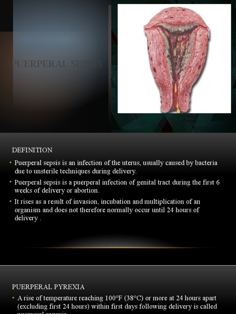 Puerperal Sepsis Causes, Symptoms, Prevention and Treatment | PDF ...