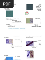 Pemeriksaan Cairan Pleura | PDF