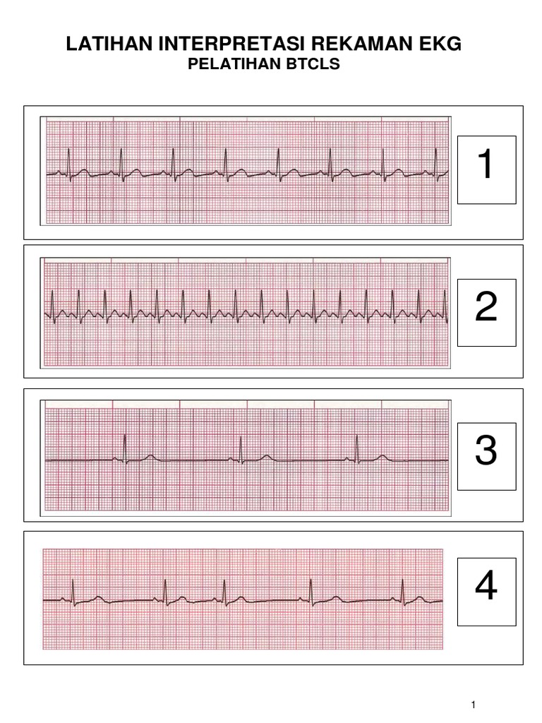Latihan Interpretasi EKG BTCLS | PDF