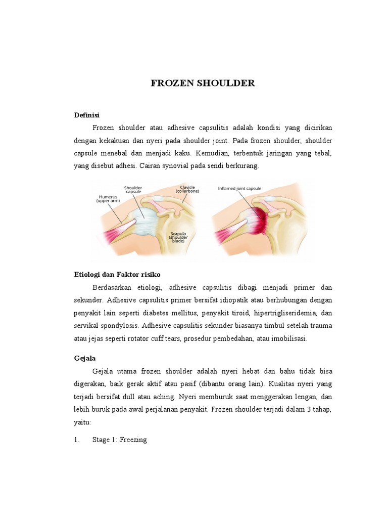 Frozen Shoulder | PDF
