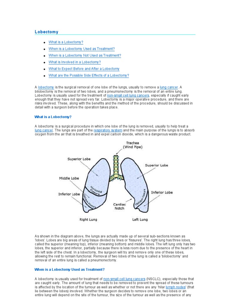 Lobectomy | Lung | Lung Cancer