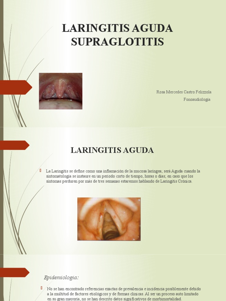Laringitis Aguda | PDF