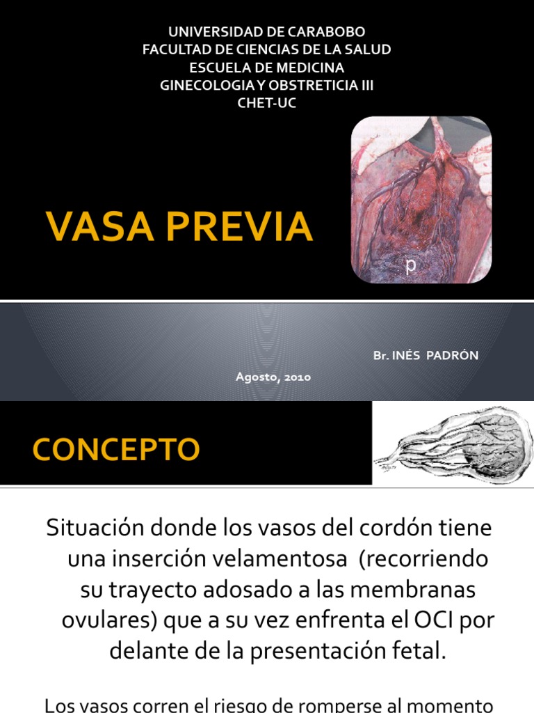 Vasa Previa | PDF