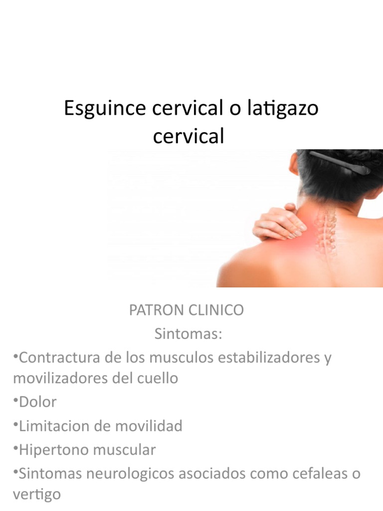 Esguince Cervical Síntomas Y Tratamiento Pdf Dolor Punto Gatillo