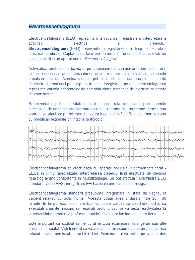 Electroencefalograma | PDF