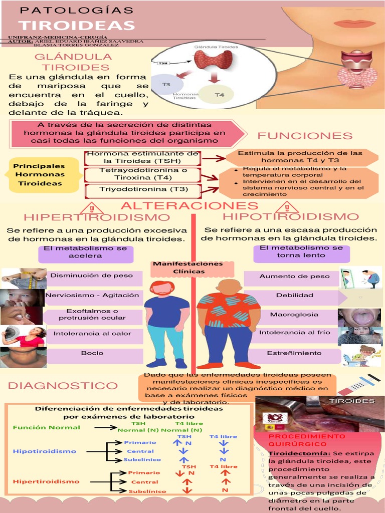 Infografía de Tiroides | PDF | Tiroides | Hormona estimulante de la tiroides