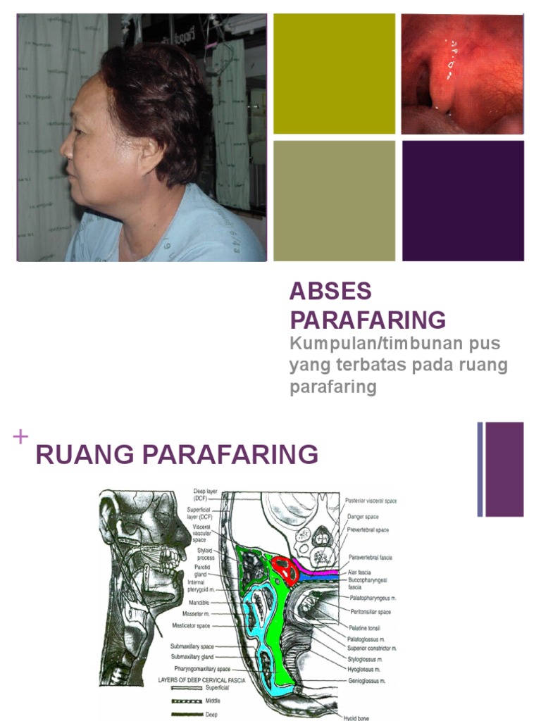 Abses Parafaring: Gejala, Diagnosis, dan Penatalaksanaan | PDF