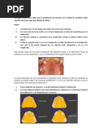 La Línea de Fulcro | PDF | Dentadura postiza | Naturaleza