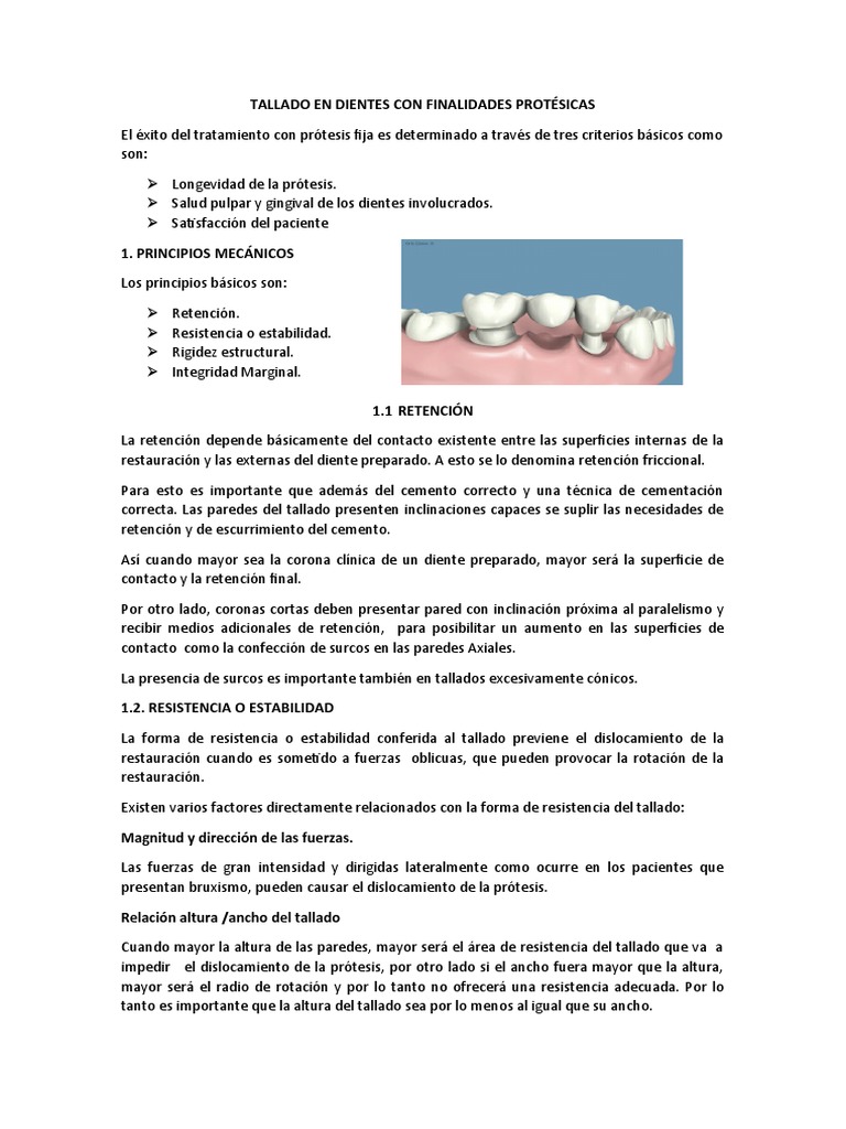 Tallado en Dientes Con Finalidades Protésicas | PDF | Dentadura postiza ...
