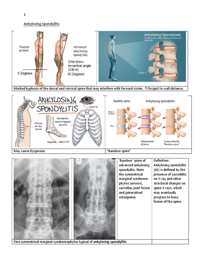 Anky Spondy | PDF | Diseases And Disorders | Immunology