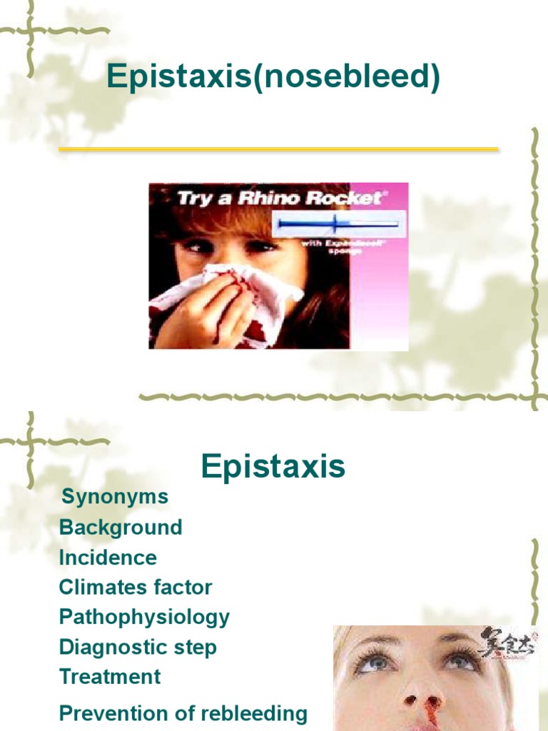 6 Epistaxis | PDF | Human Nose | Respiratory System