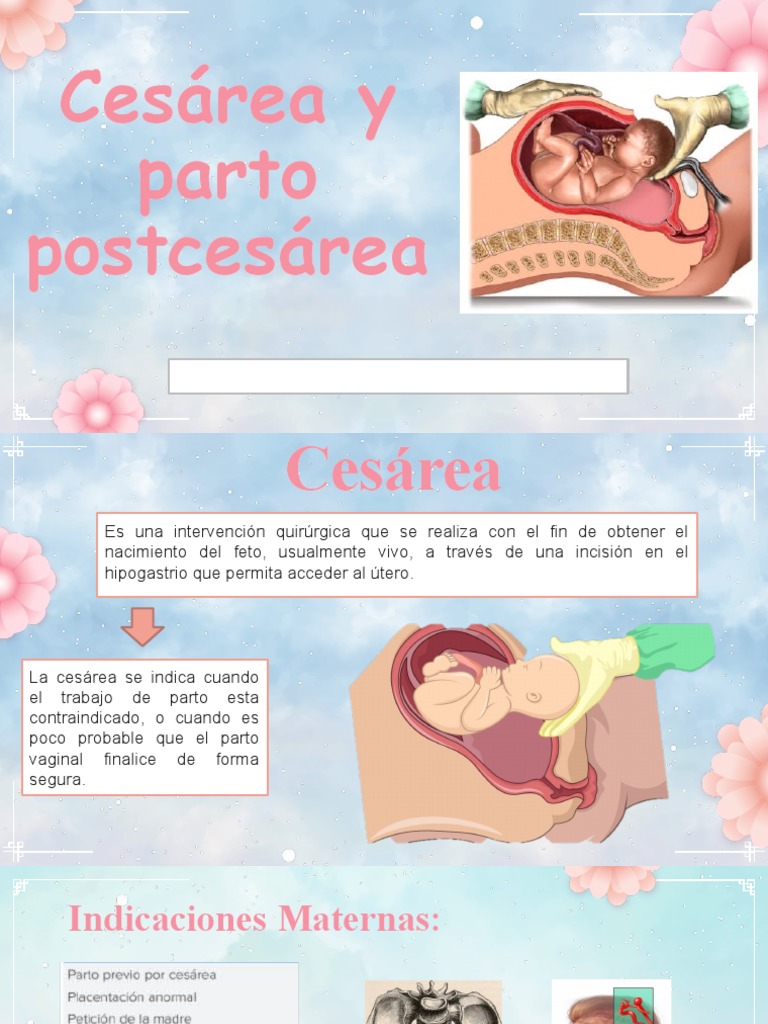Cesárea y Parto Postcesárea: Guía Completa | PDF | Parto | Seccion de ...