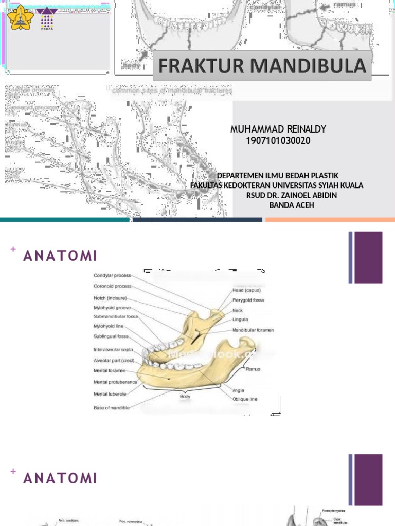 Fraktur Mandibula: Penyebab & Penanganan | PDF