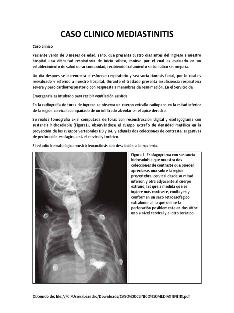 Caso Clinico Mediastinitis | PDF | Medicina CLINICA | Enfermedades y trastornos