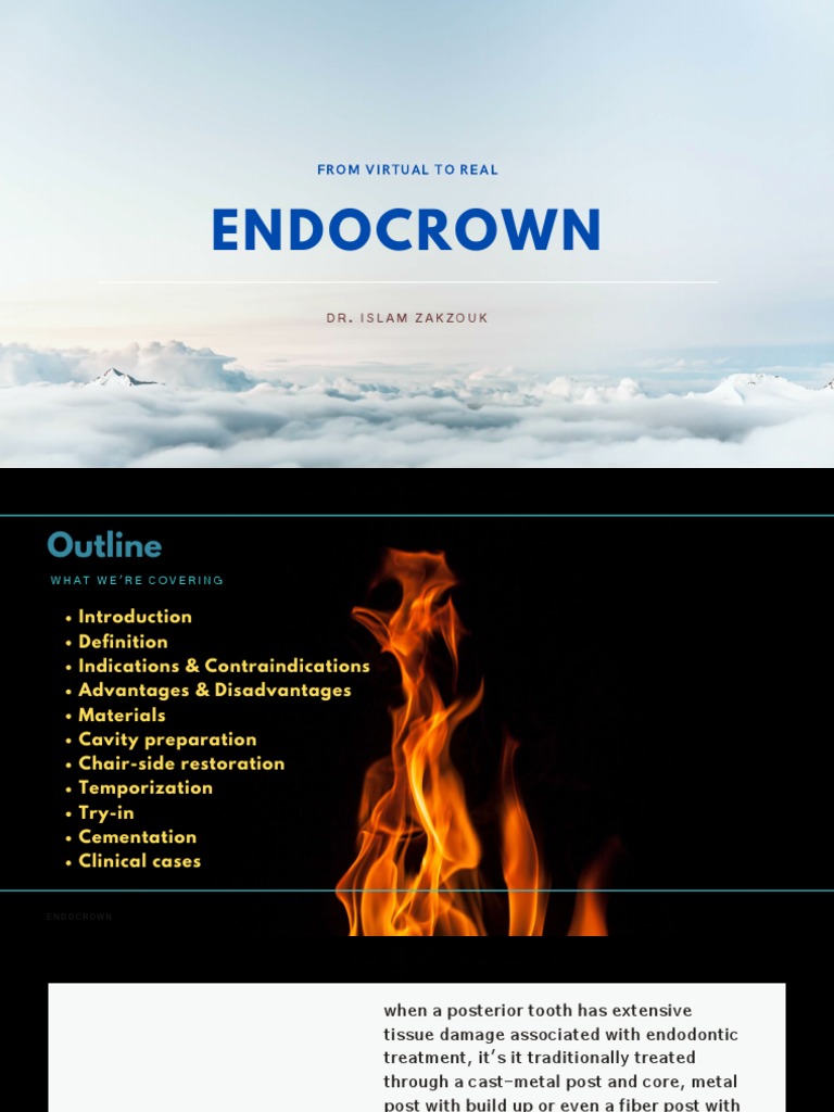 Endocrown Compressed | PDF | Dentistry | Dentistry Branches