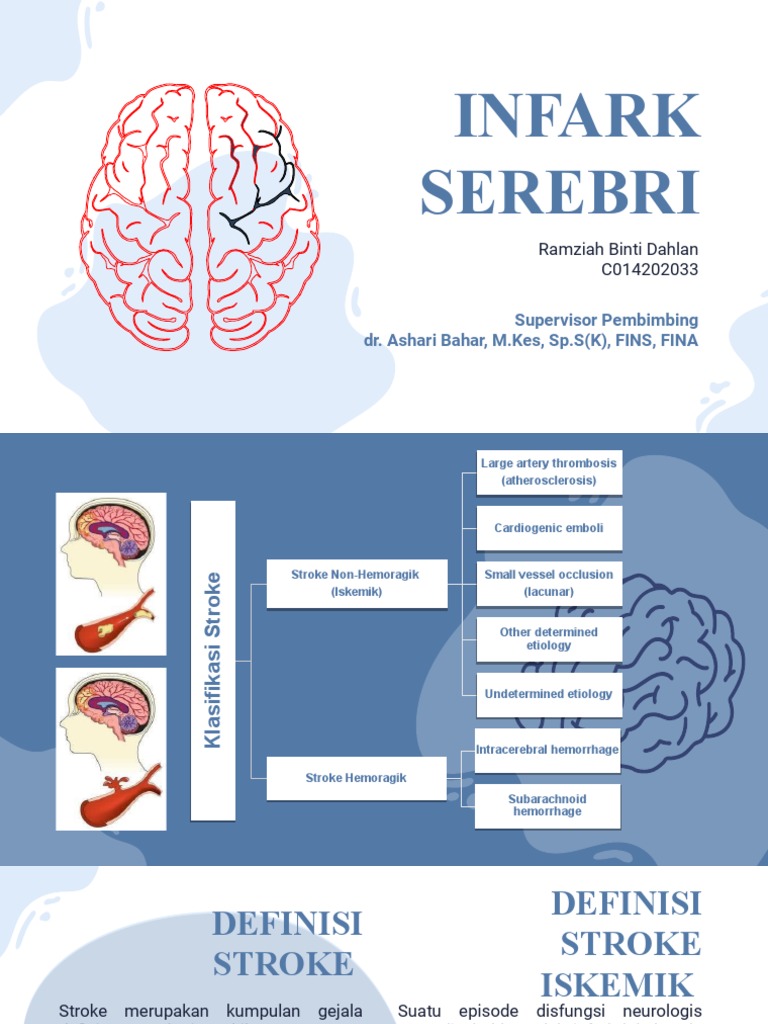 Infark Serebri Referat Ramziah Dahlan | PDF