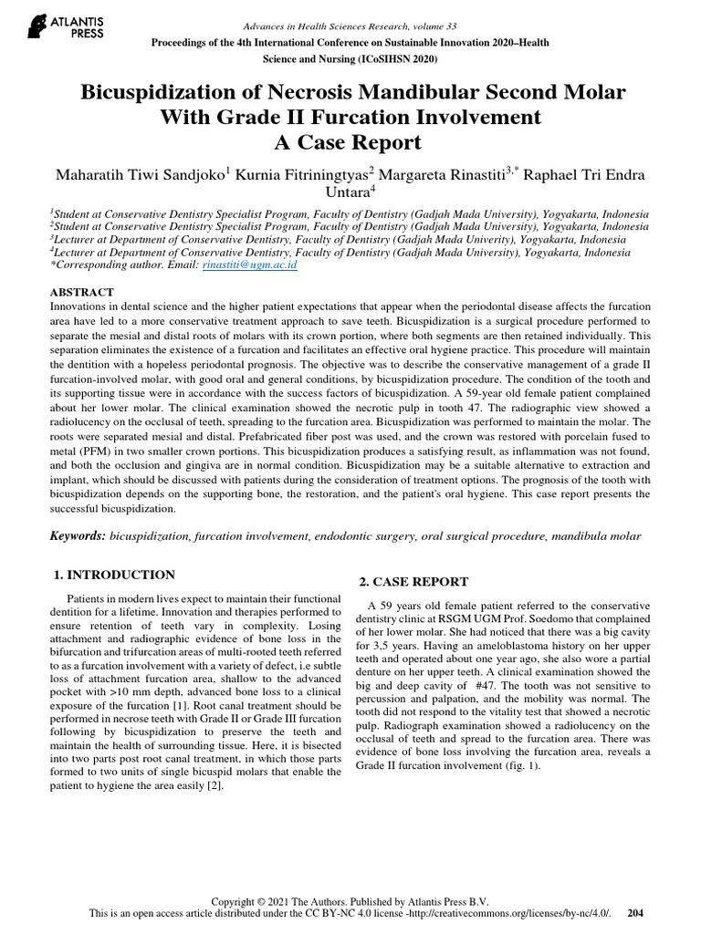 Bicuspidization of Necrosis Mandibular Second Molar With Grade II ...
