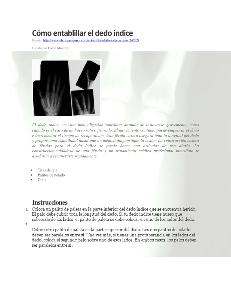 Cómo entablillar un dedo índice correctamente | PDF
