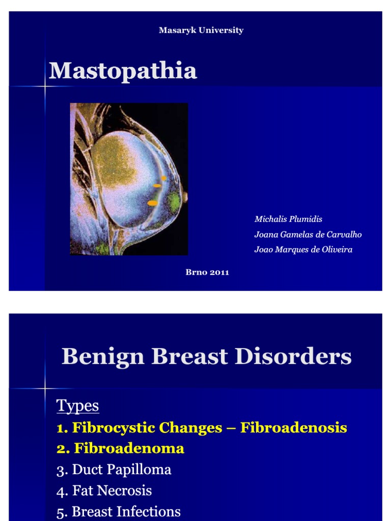 Mastopathia | Secondary Sexual Characteristics | Gynaecology