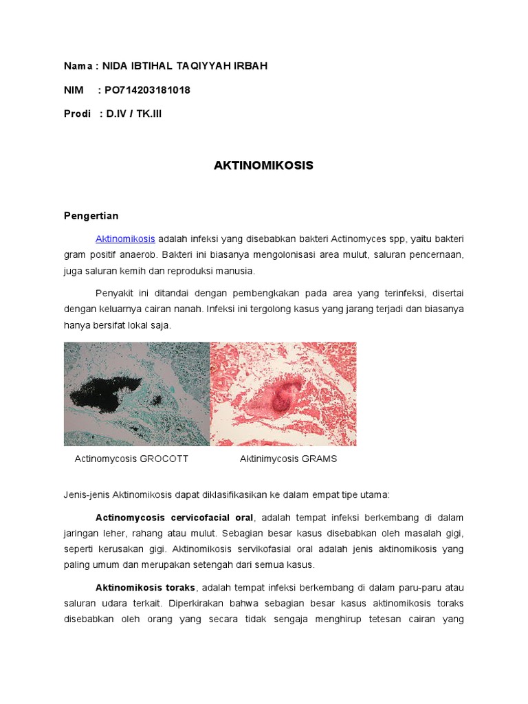 Aktinomikosis: Penyebab, Gejala, Diagnosis, dan Pengobatan Infeksi Bakteri Actinomyces | PDF