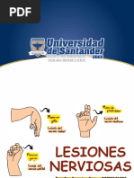 Mano en Garra: Causas y Tratamientos | PDF | Mano | Nervio