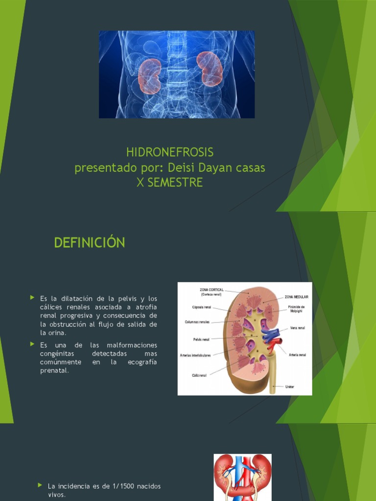 Hidronefrosis: Definición, Embriología, Anatomía, Fisiopatología ...