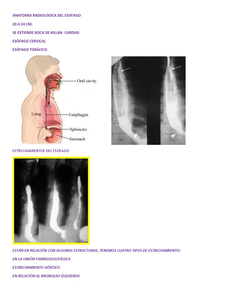 Anatomia Radiologica Del Esofago | PDF | Estómago | Esófago