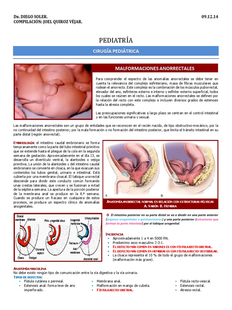 Tema 9 (Malformaciones Anorrectales) | PDF | Especialidades Medicas | Medicina CLINICA