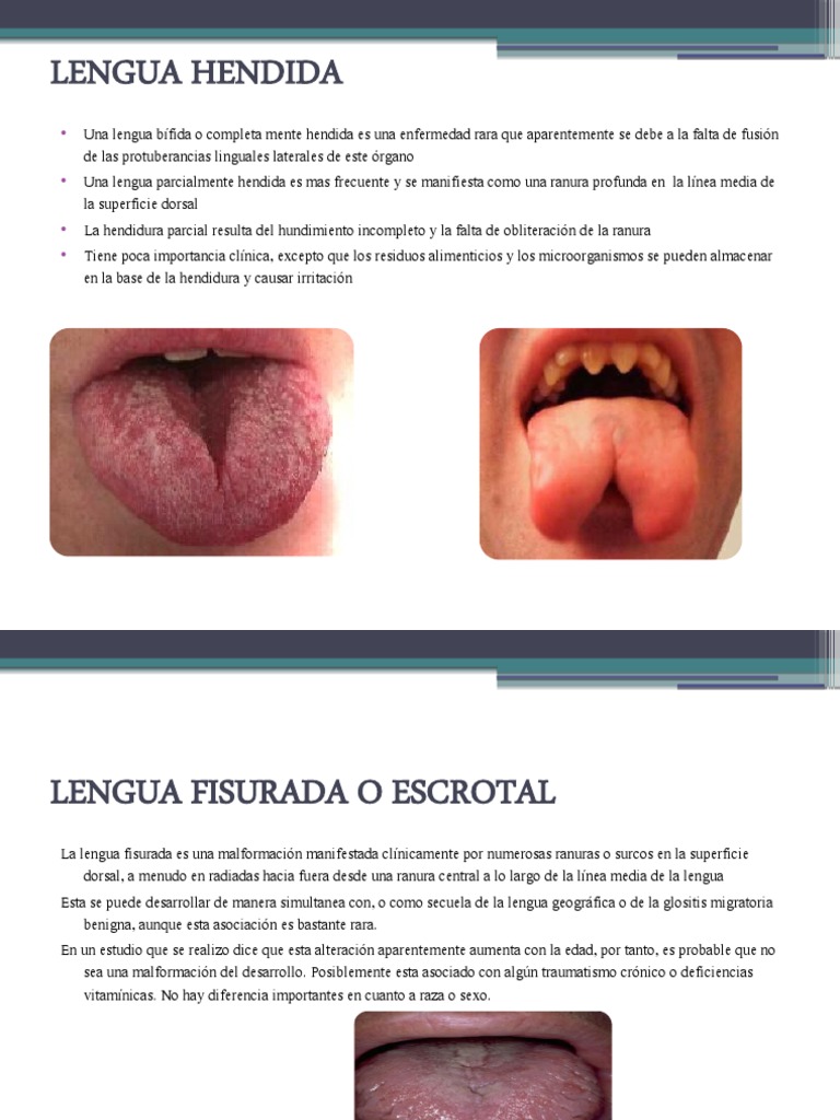 Lengua Hendida | PDF | Medicina CLINICA | Especialidades Medicas
