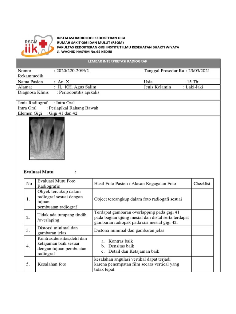 Interpretasi Periapikal Anterior RB | PDF