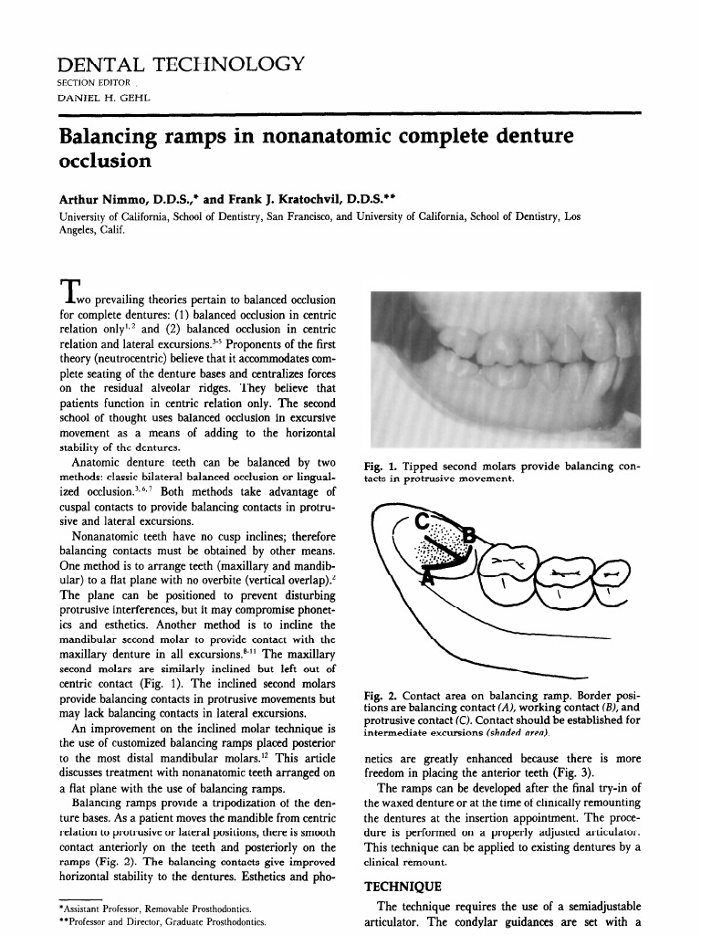 Balancing Ramps in Nonanatomic Complete Denture | PDF | Dentures ...