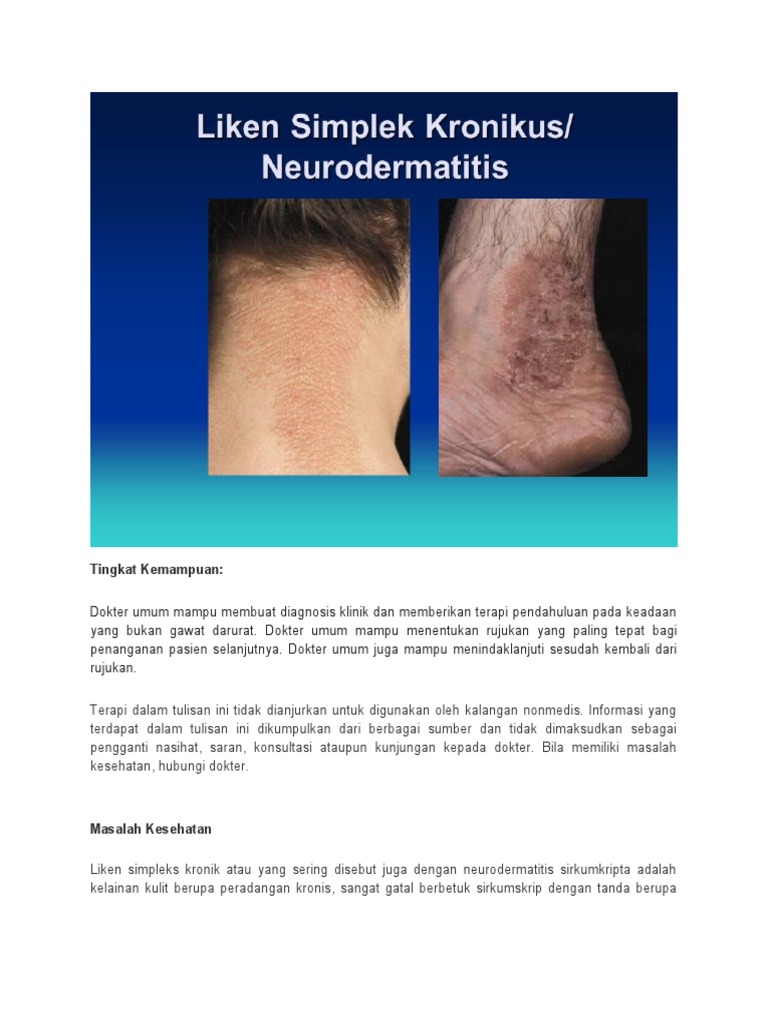 Liken Simplek Kronikes | PDF | Sains & Matematika