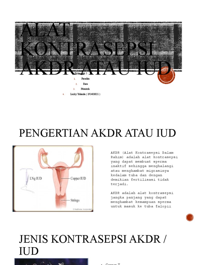 Kel 5 - KB IUD | PDF