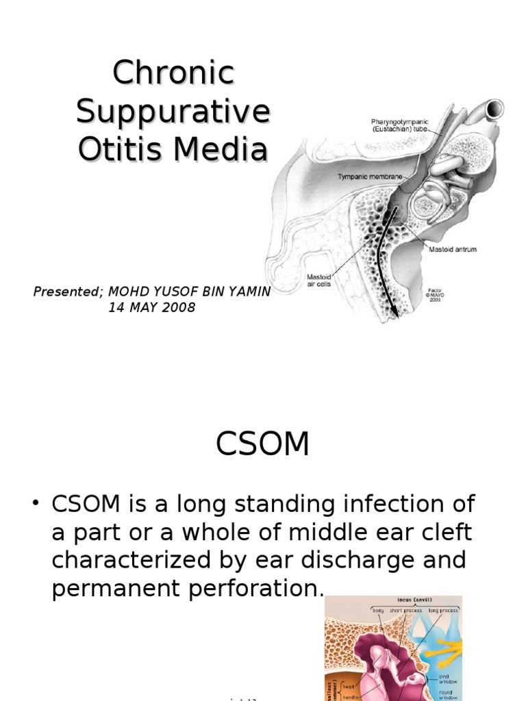Types and Treatment of CSOM | PDF