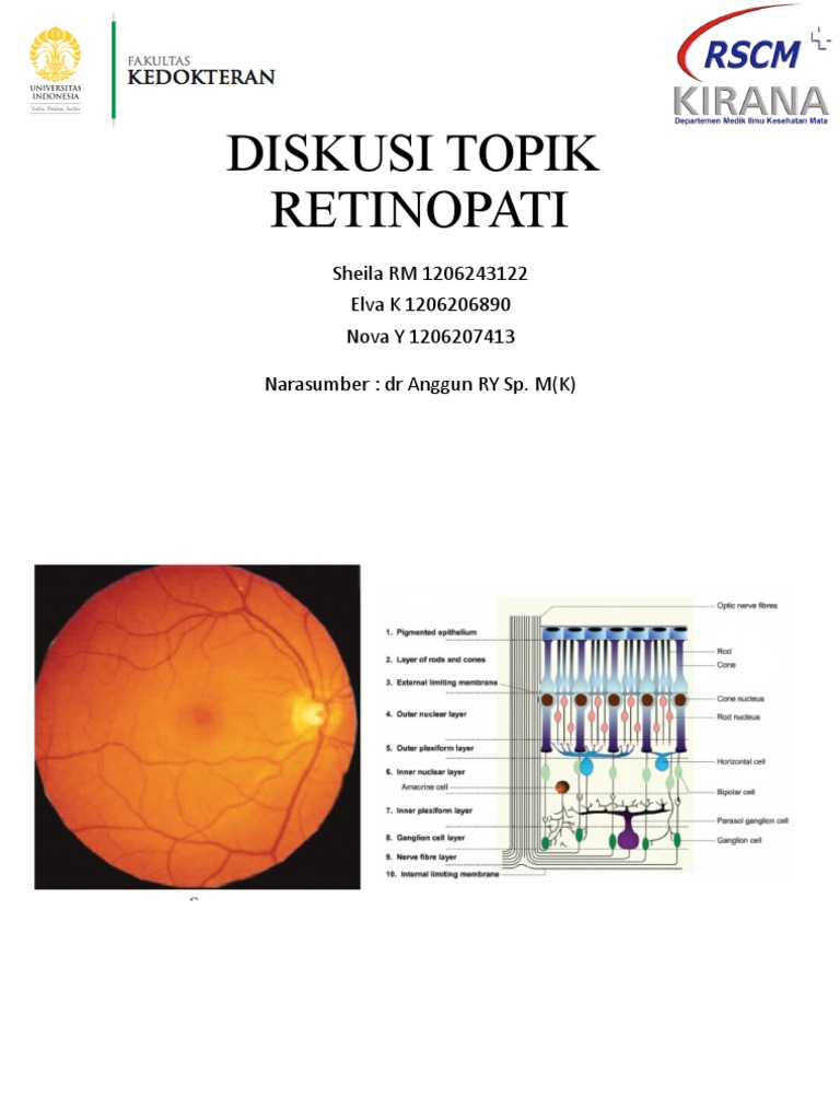 Retinopati Diabetes: Gejala dan Diagnosis | PDF