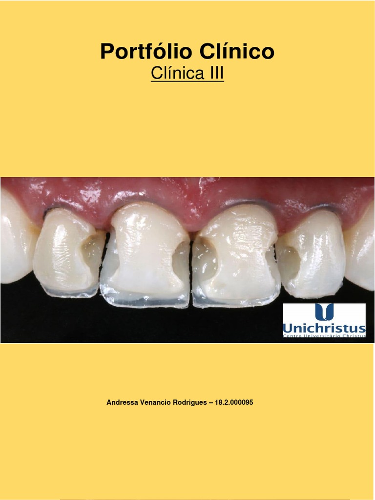 Restauração Classe III | PDF | Áreas da odontologia | Boca