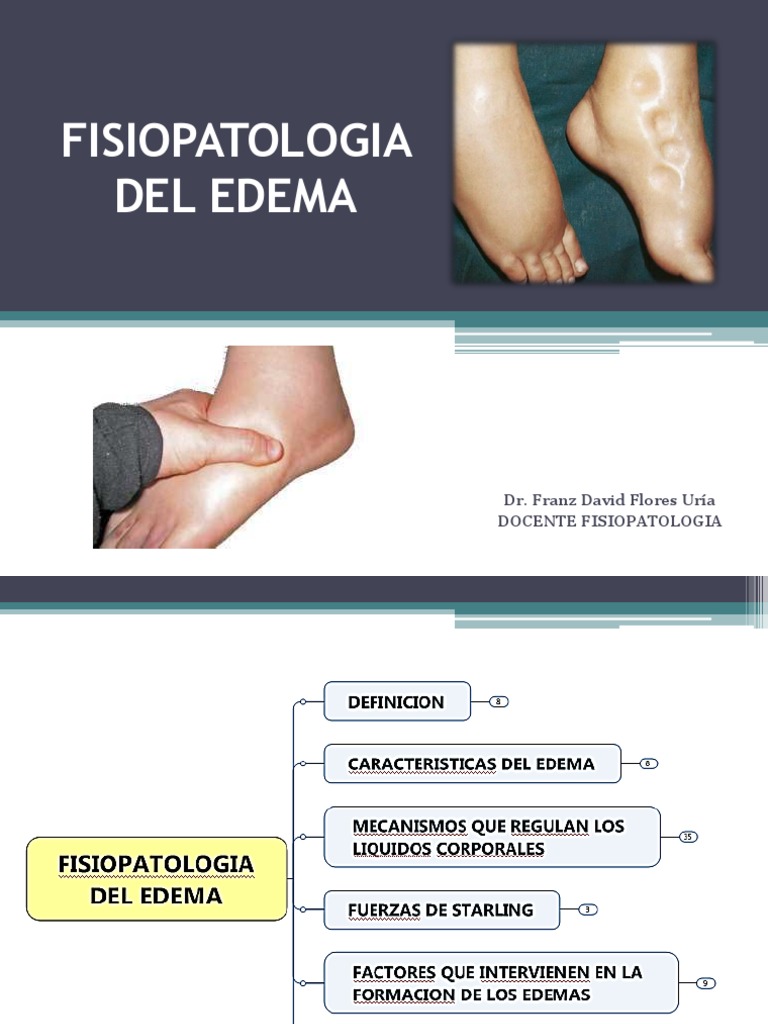 Fisiopatología del Edema: Mecanismos y Tipos | PDF | Edema ...