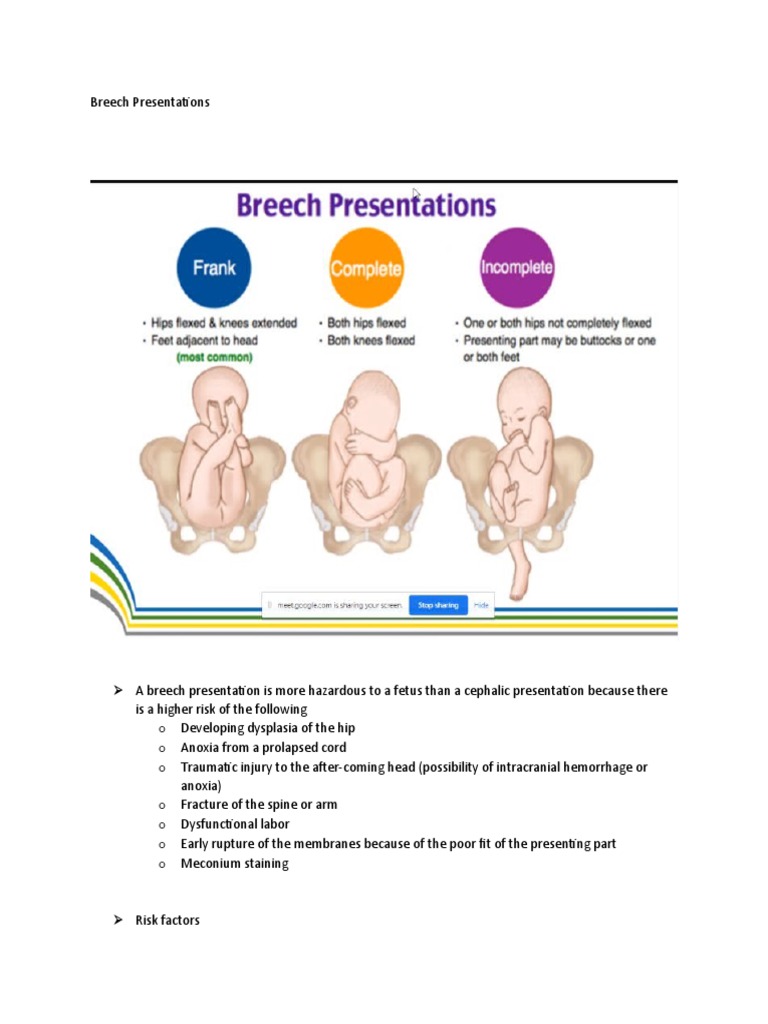 Breech Presentations | PDF | Childbirth | Fetus