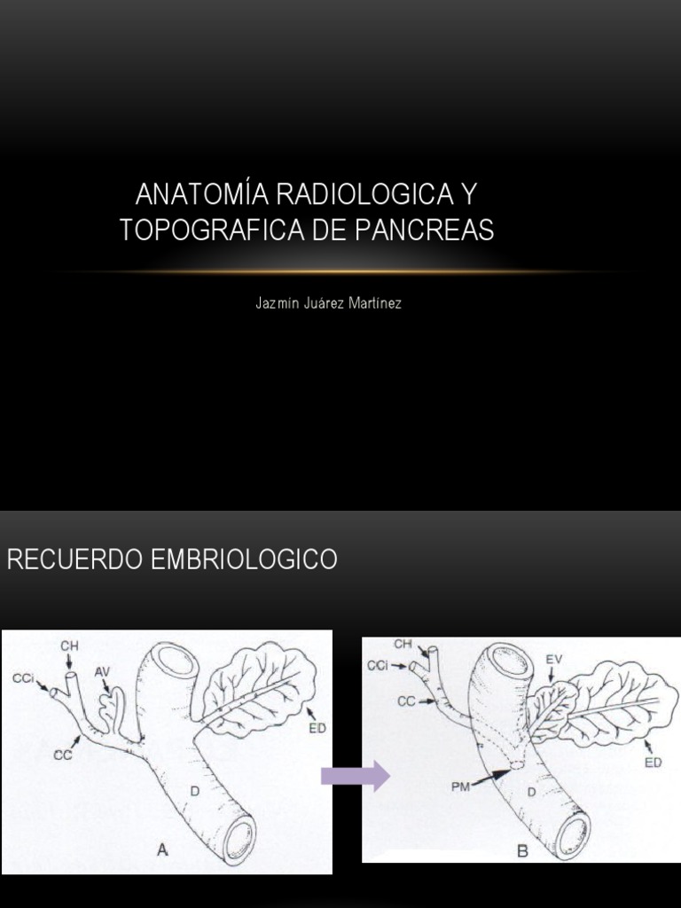 Anatomía de Pancreas | PDF | Páncreas | Abdomen