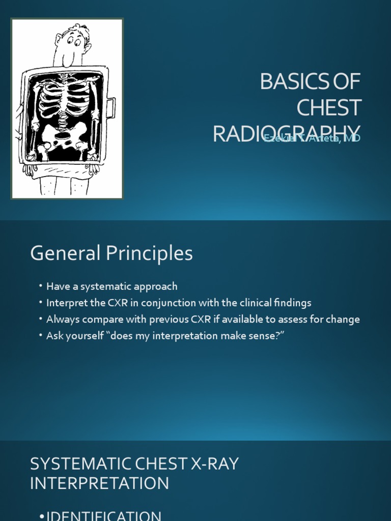 Key Concepts in Chest Radiography | PDF | Lung | Anatomy