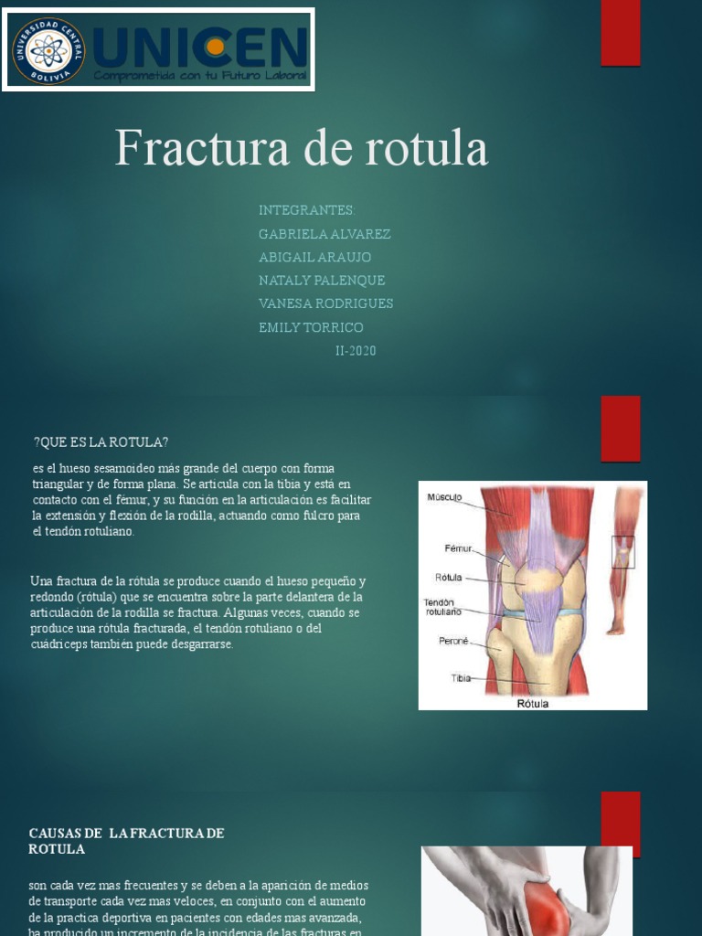 Fractura de Rotula . | PDF | Rodilla | Articulaciones