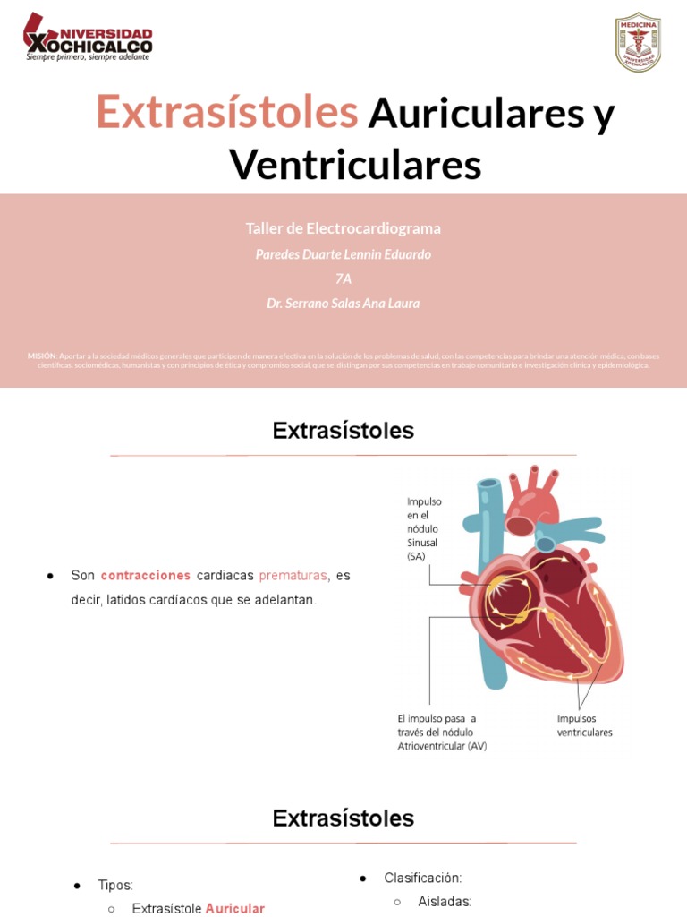 Extrasistoles A y V | PDF | Electrocardiografia | Medicina